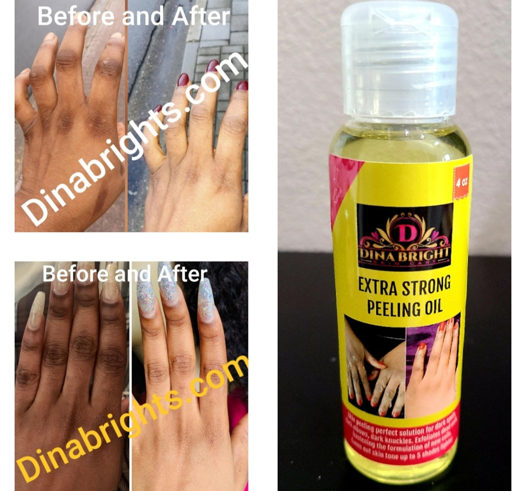 Dark knuckles & Elbows Peeling oil – Dina Bright Skin Care